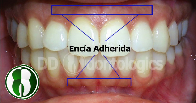 Conoce todo sobre tus Encías - La información más completa sobre su cuidado